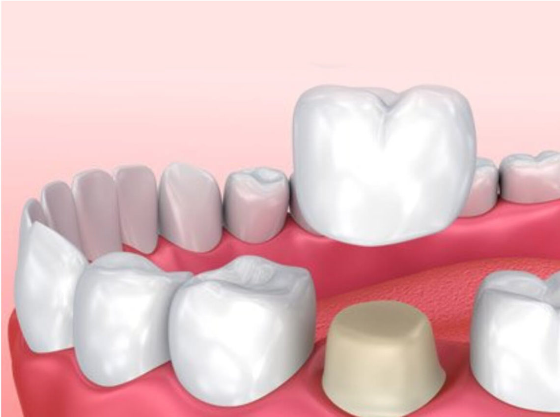 Scottsdale Cosmetic Dentist - Family Dentistry AZ | Mitchell Dental